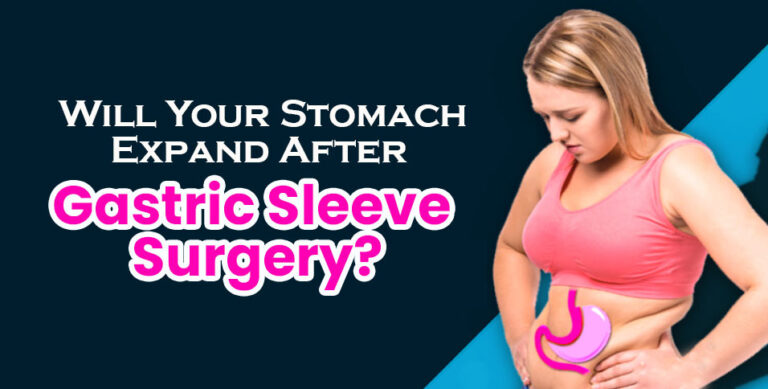 Will Your Stomach Expand After Gastric Sleeve Surgery?