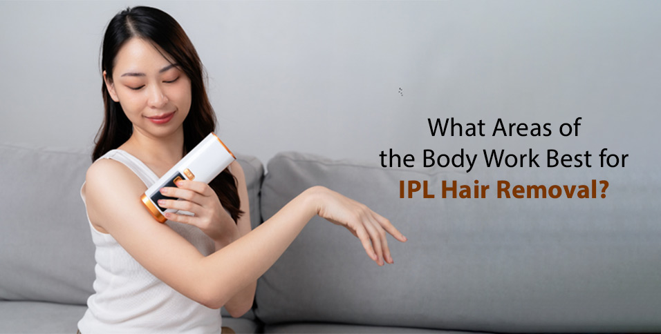 What Areas of the Body Work Best for IPL Hair Removal?